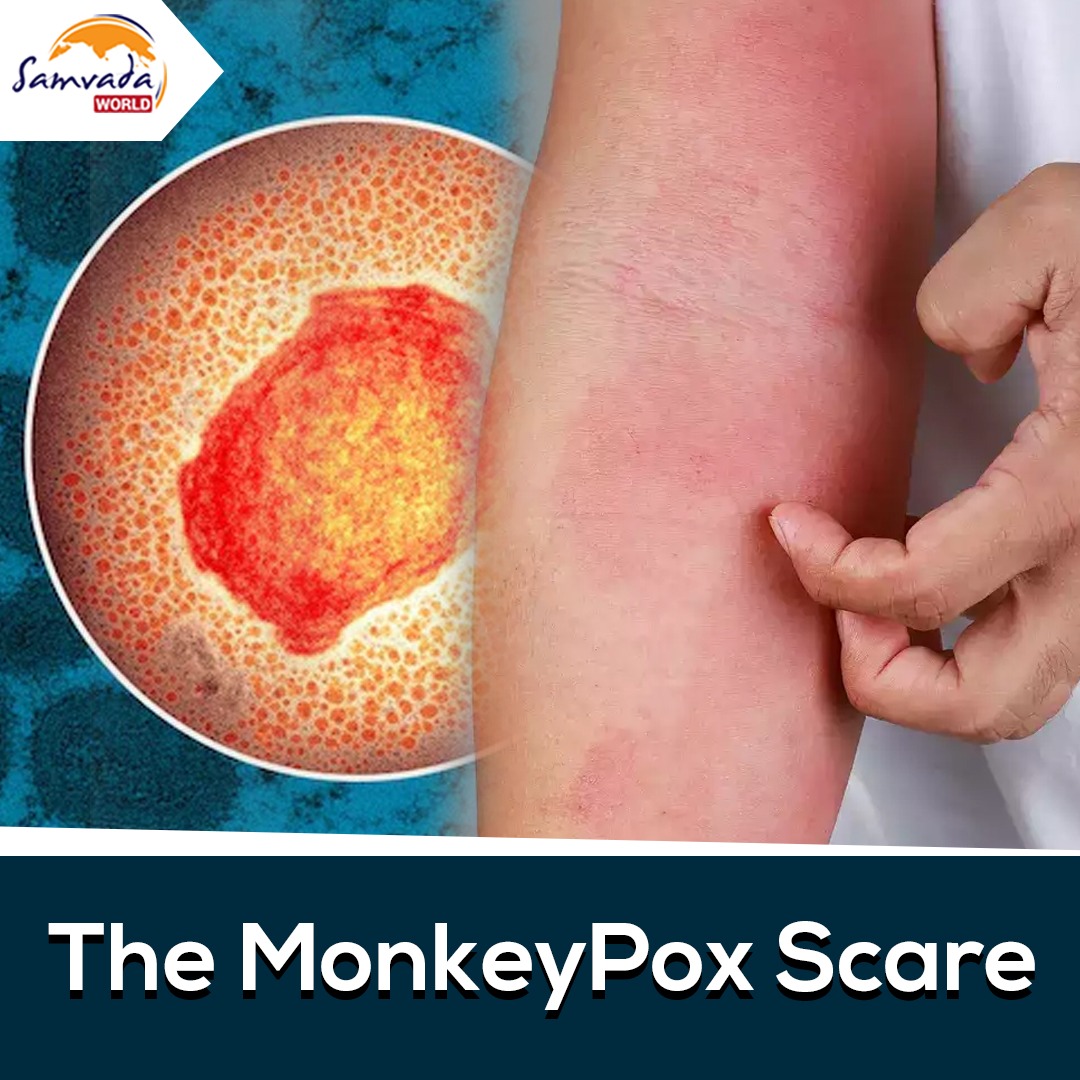 What is MonkeyPox and why is it causing a scare worldwide? Samvada World